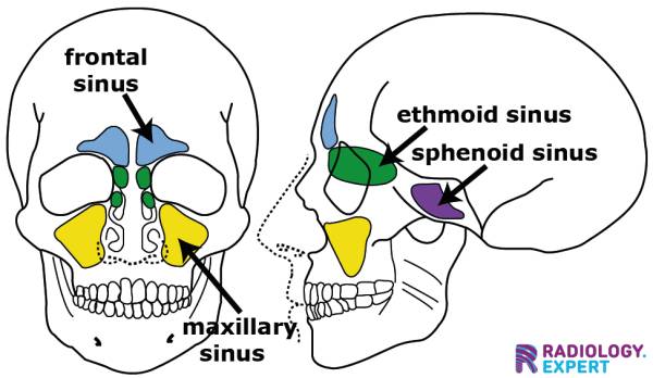 CT sinus