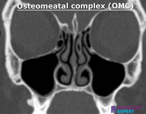 CT sinus