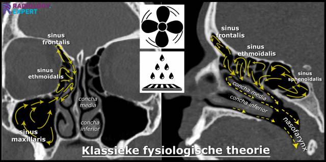 CT sinus