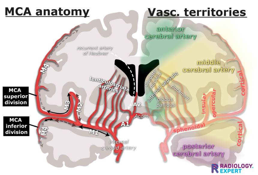 Interventional Radiology - The Stroke Patient