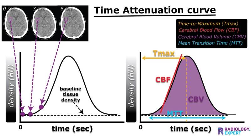 Interventional Radiology - The Stroke Patient