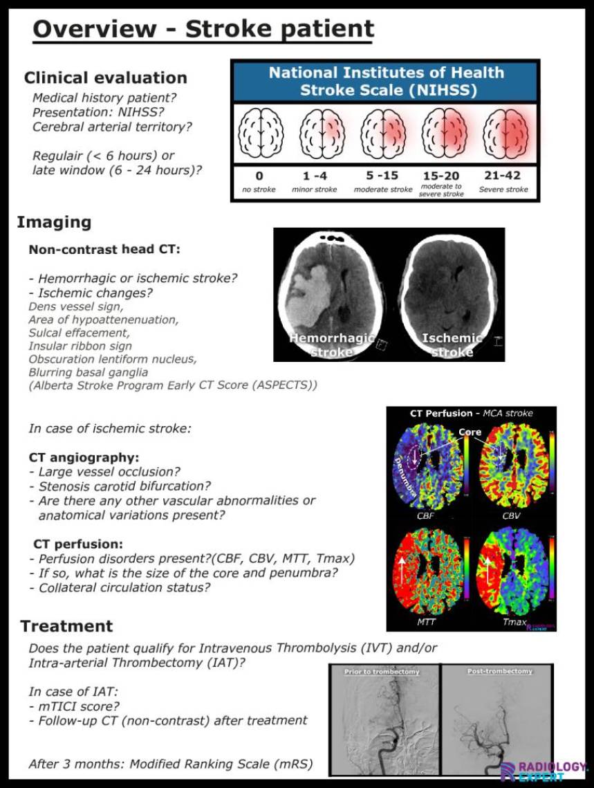 Interventional Radiology - The Stroke Patient
