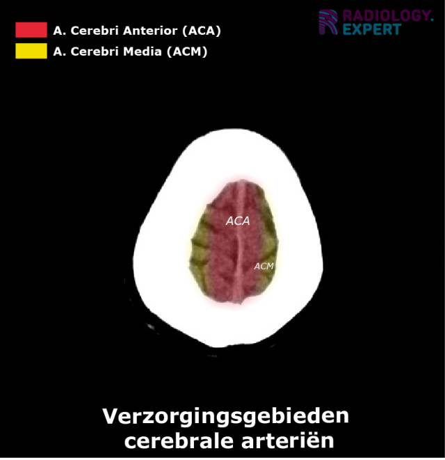 Interventieradiologie - De CVA Patient