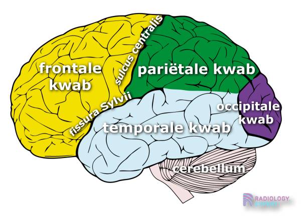 Interventieradiologie - De CVA Patient