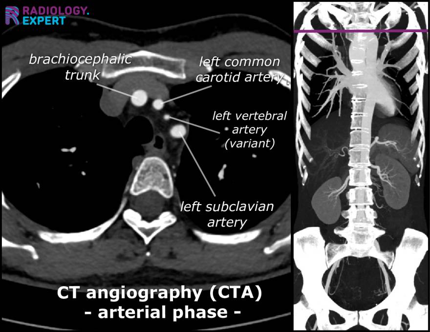 Interventional Radiology - Non-Oncological