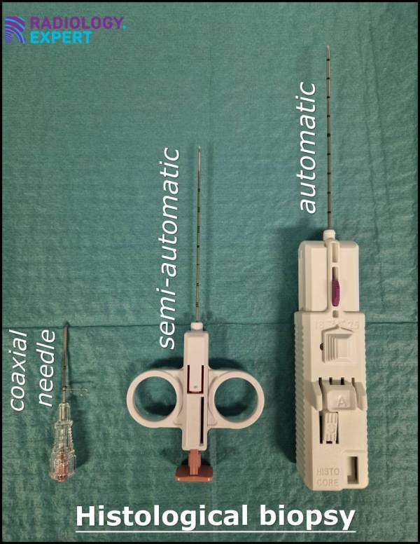 Interventional Radiology - Non-Oncological
