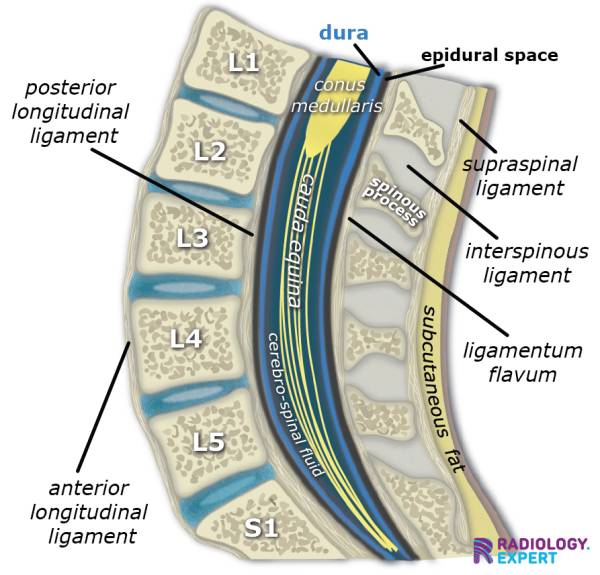MRI Lumbar Spine