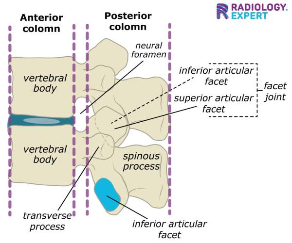 MRI Lumbar Spine