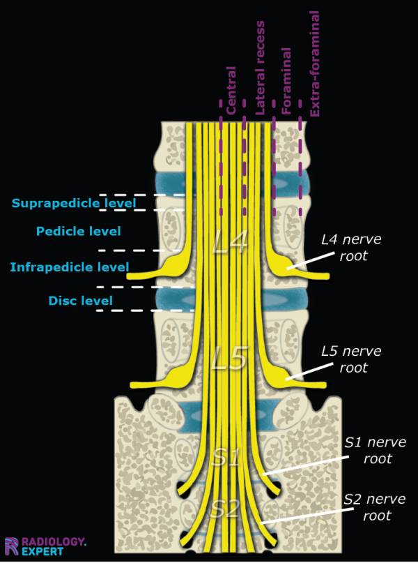 MRI Lumbar Spine