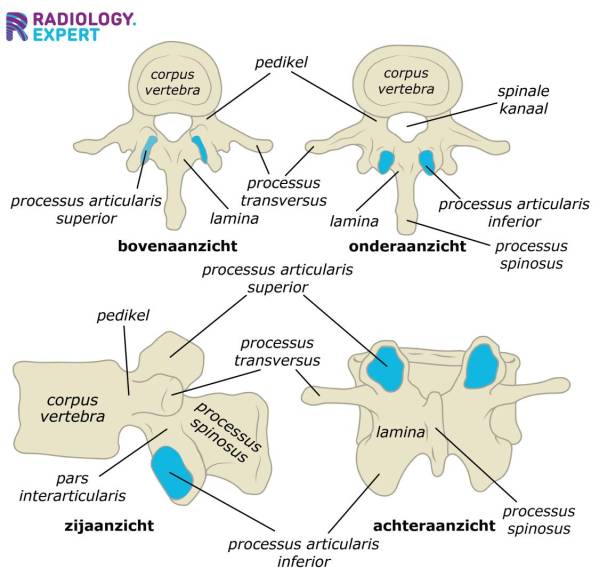 MRI lumbale wervelkolom