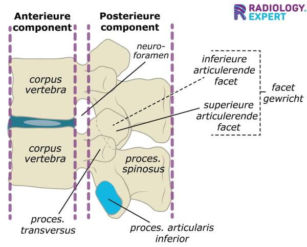 MRI lumbale wervelkolom