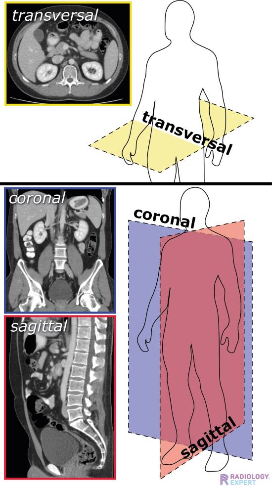 CT abdomen general