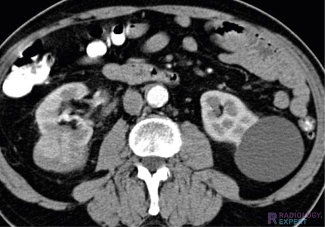 CT abdomen general