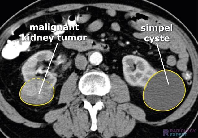 CT abdomen general