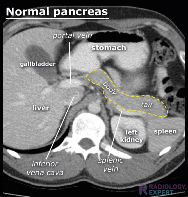 Abdomen Anatomy Xray at Fred Morales blog