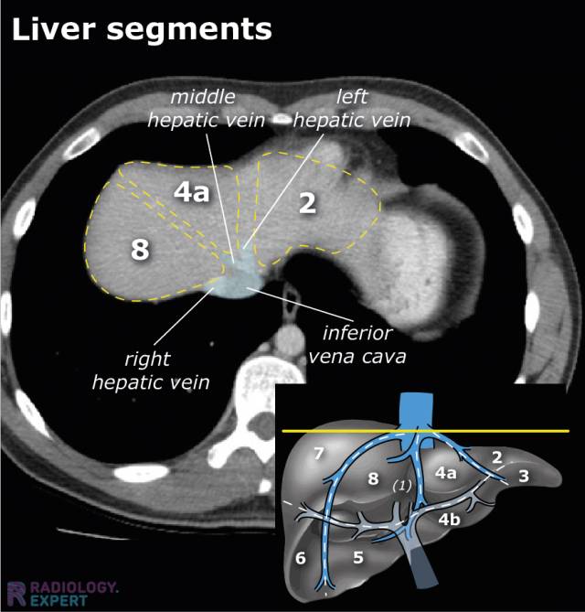 Liver Segments Ct