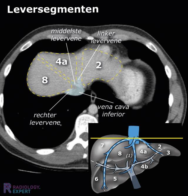 CT abdomen algemeen