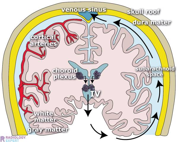 CT brain hemorrhage