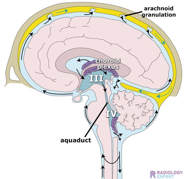 CT brain hemorrhage