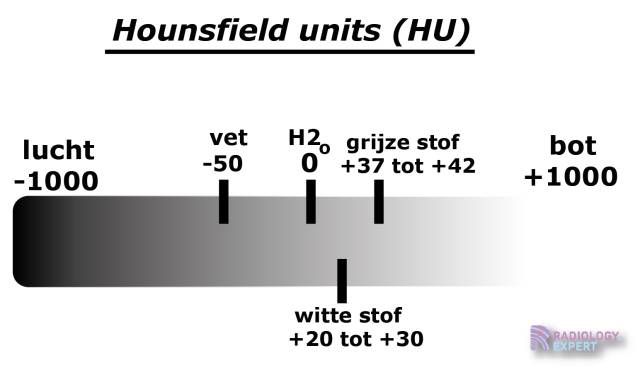 CT hersenen bloeding