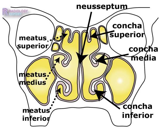 CT sinus