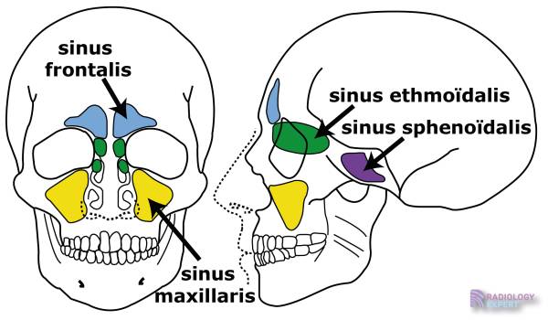 CT sinus