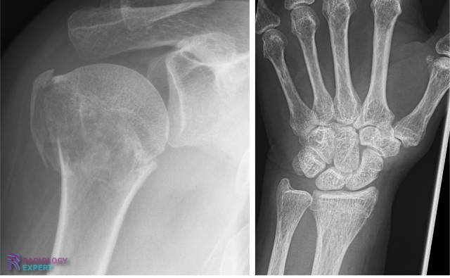 Fracture general principles