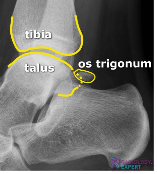 Fracture general principles