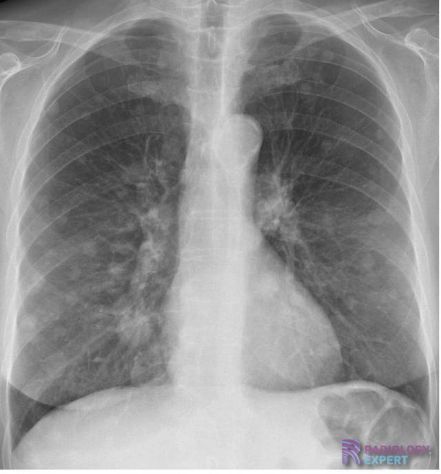 Indication and Requests for Radiological Examination