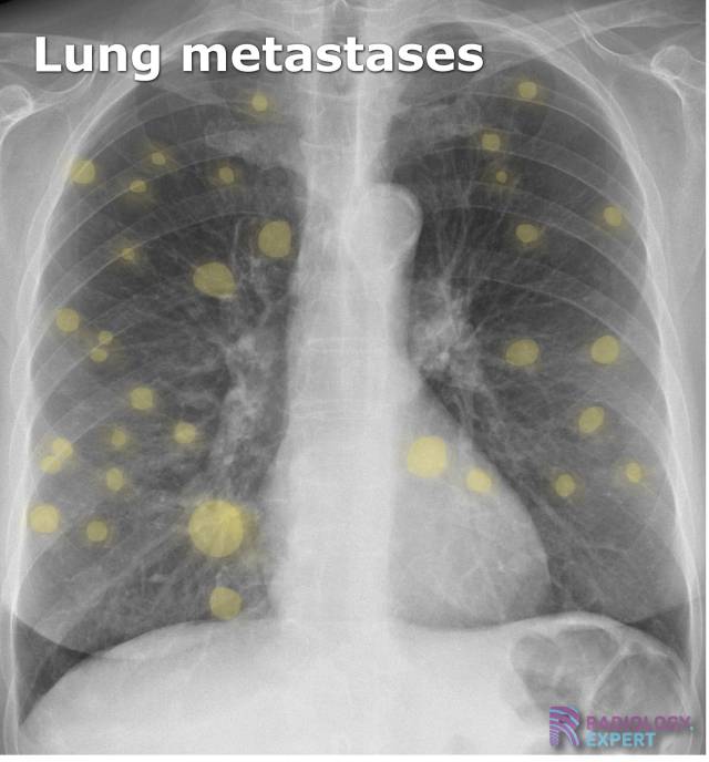 Indication and Requests for Radiological Examination