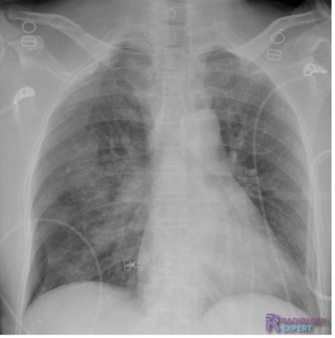 Indication and Requests for Radiological Examination