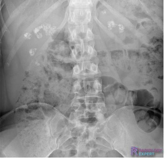 Indication and Requests for Radiological Examination