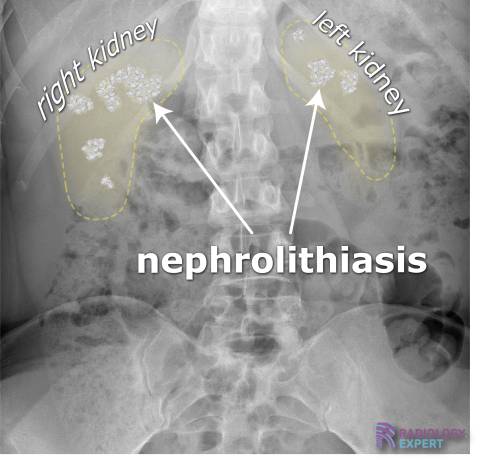 Indication and Requests for Radiological Examination