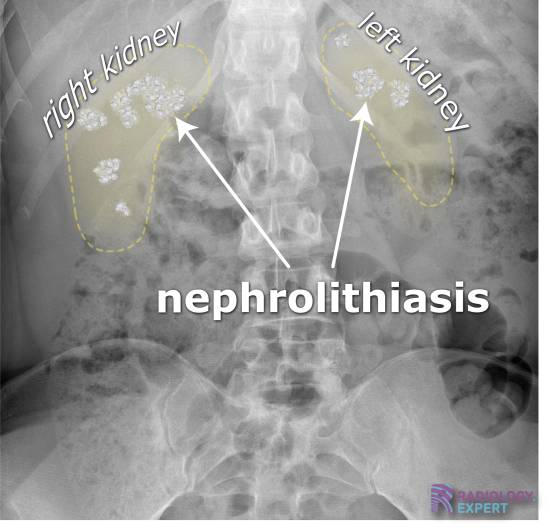 Indication and Requests for Radiological Examination