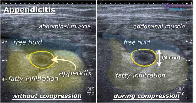 Indication and Requests for Radiological Examination