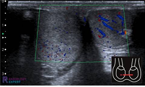 Indication and Requests for Radiological Examination