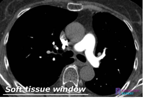Indication and Requests for Radiological Examination