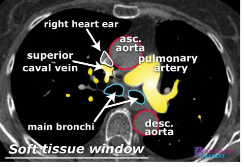 Indication and Requests for Radiological Examination