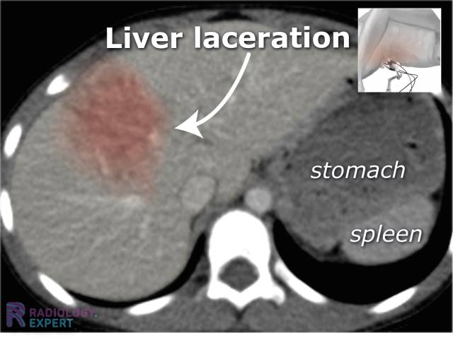 Indication and Requests for Radiological Examination