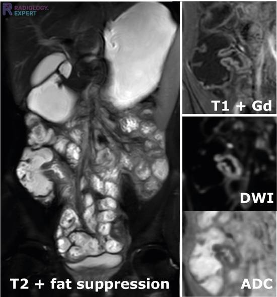 Indication and Requests for Radiological Examination