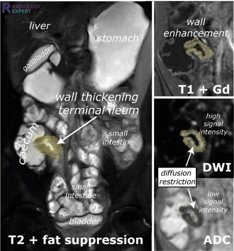 Indication and Requests for Radiological Examination