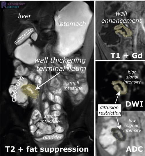 Indication and Requests for Radiological Examination