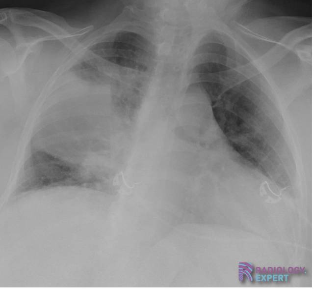 Indication and Requests for Radiological Examination