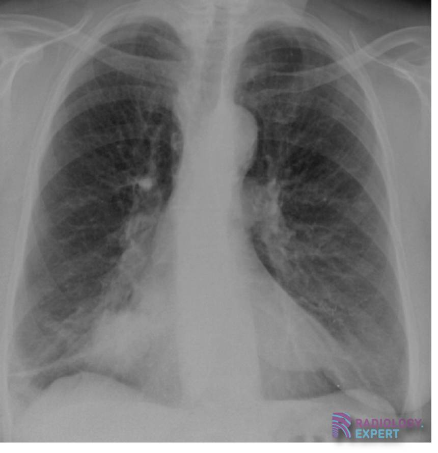 Indication and Requests for Radiological Examination