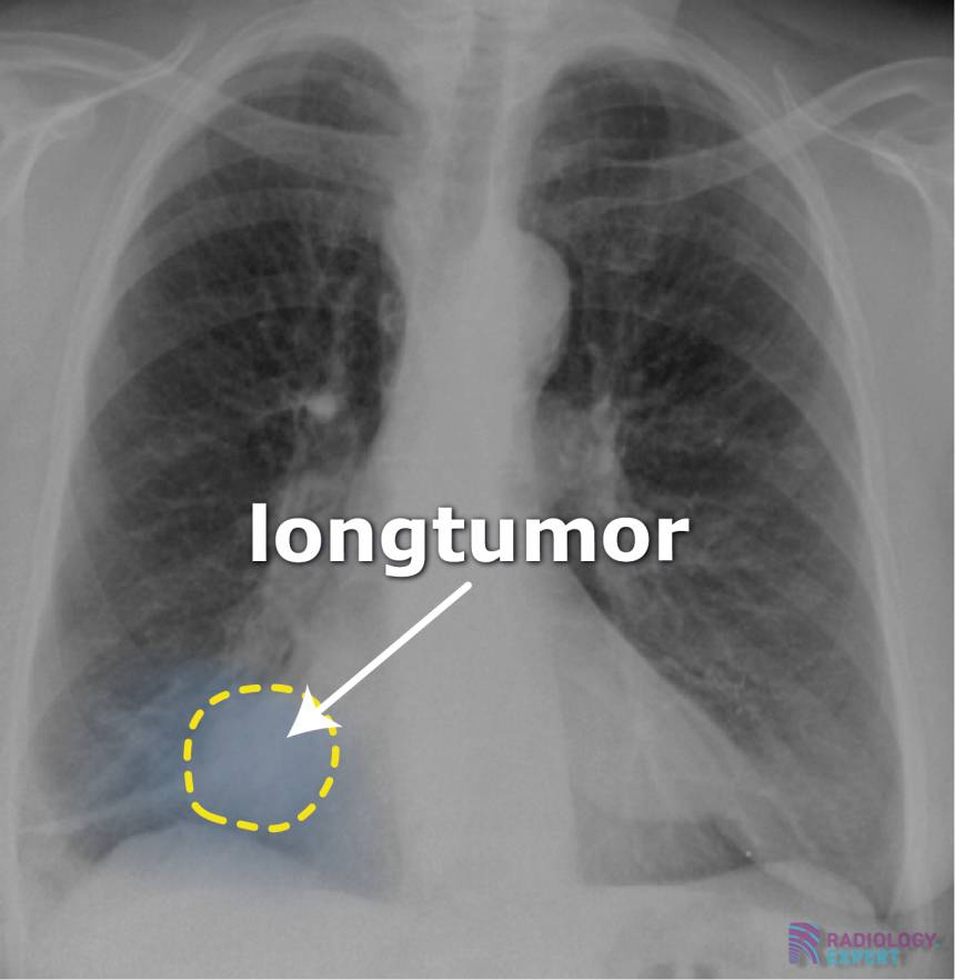 Indicatiestelling en Aanvragen Radiologisch Onderzoek