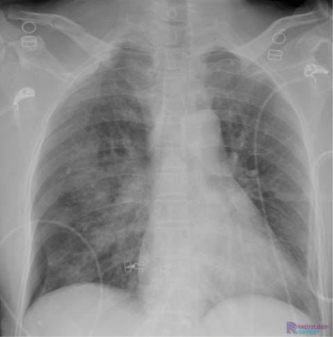 Indicatiestelling en Aanvragen Radiologisch Onderzoek