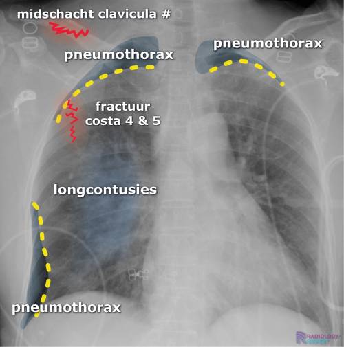 Indicatiestelling en Aanvragen Radiologisch Onderzoek