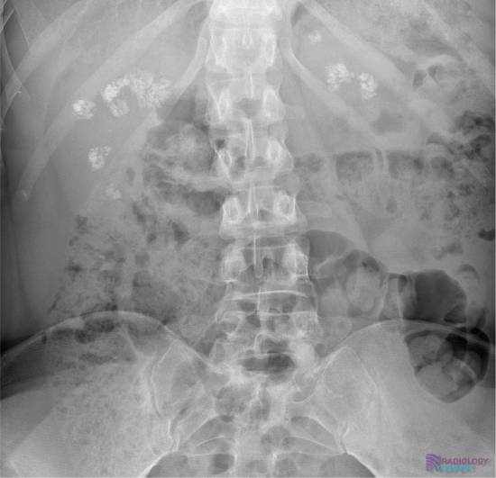Indicatiestelling en Aanvragen Radiologisch Onderzoek