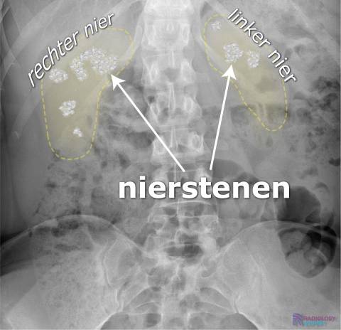Indicatiestelling en Aanvragen Radiologisch Onderzoek