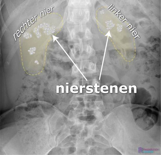 Indicatiestelling en Aanvragen Radiologisch Onderzoek
